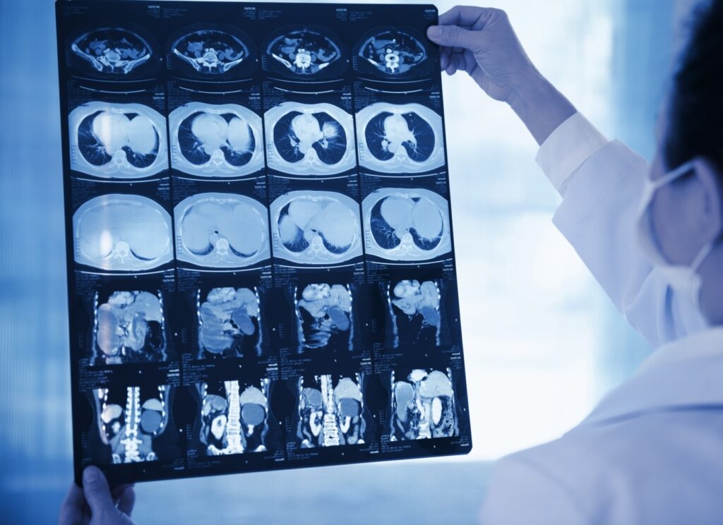 Scanner pelvien | Centre de radiologie | Révélis | Paris