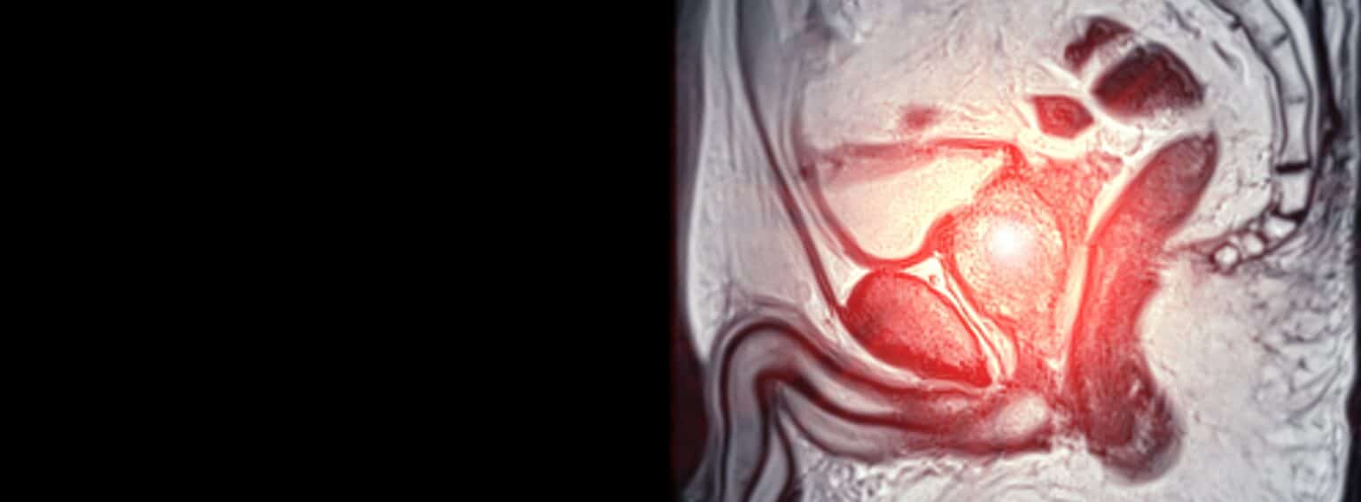 Comment se passe une IRM des voies urinaires ? | Radiologie | Révélis ...